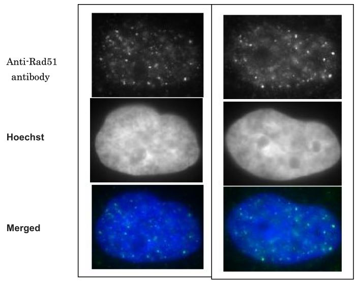 Rad51抗体 (GTX00720) | GeneTex中国官方网站