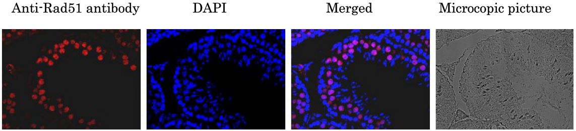 Rad51抗体 (GTX00720) | GeneTex中国官方网站