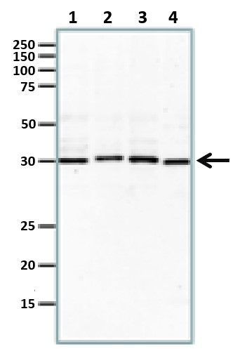 Rad51抗体 (GTX00720) | GeneTex中国官方网站