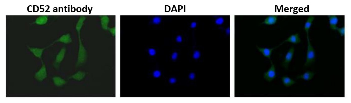 CD52抗体 (GTX00743) | GeneTex中国官方网站