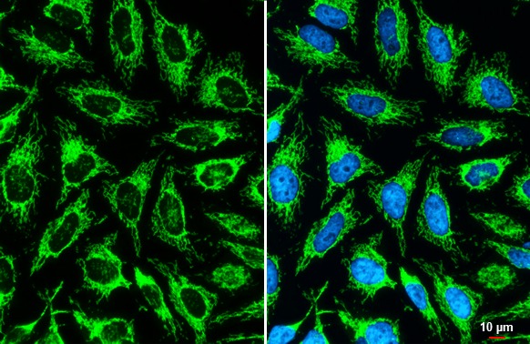 TOMM20抗体 [GT1136] (GTX00773) | GeneTex中国官方网站