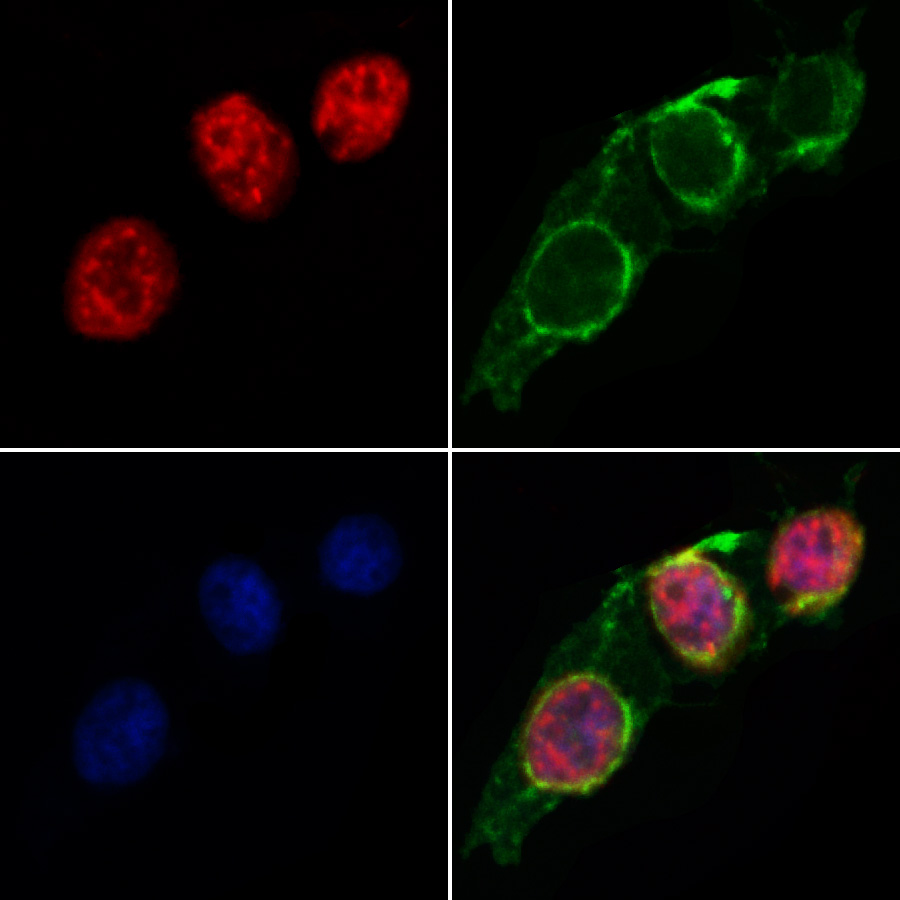 RUNX2抗体 (GTX00792) | GeneTex中国官方网站