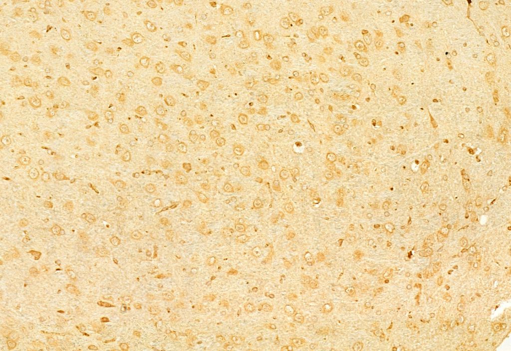 RUNX2抗体 (GTX00792) | GeneTex中国官方网站