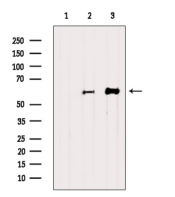 RUNX2抗体 (GTX00792) | GeneTex中国官方网站