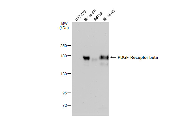 PDGF Receptor beta抗体 [GT1140] (GTX00798) | GeneTex中国官方网站