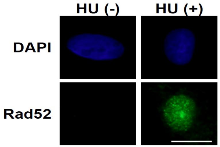 Rad52抗体 (GTX00884) | GeneTex中国官方网站