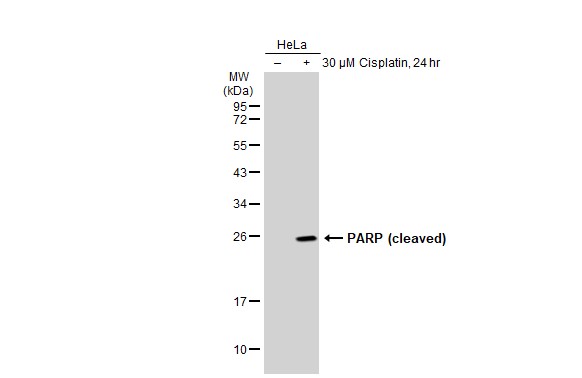 PARP (cleaved)抗体 [GT1181] (GTX00943) | GeneTex中国官方网站