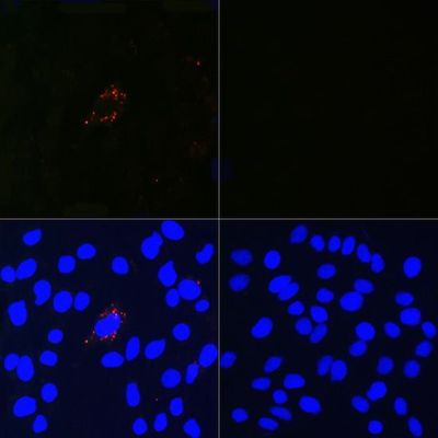 LC3B抗体 [GT1187] (GTX00949) | GeneTex中国官方网站