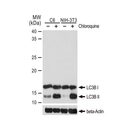 LC3B抗体 [GT1187] (GTX00949) | GeneTex中国官方网站