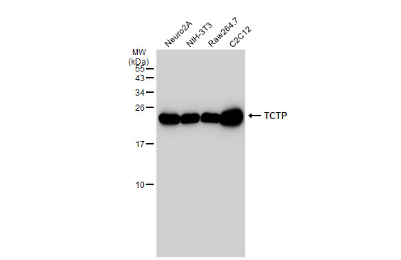 TCTP antibody [JU13-32]价格,详情介绍-960化工网 – 960化工网