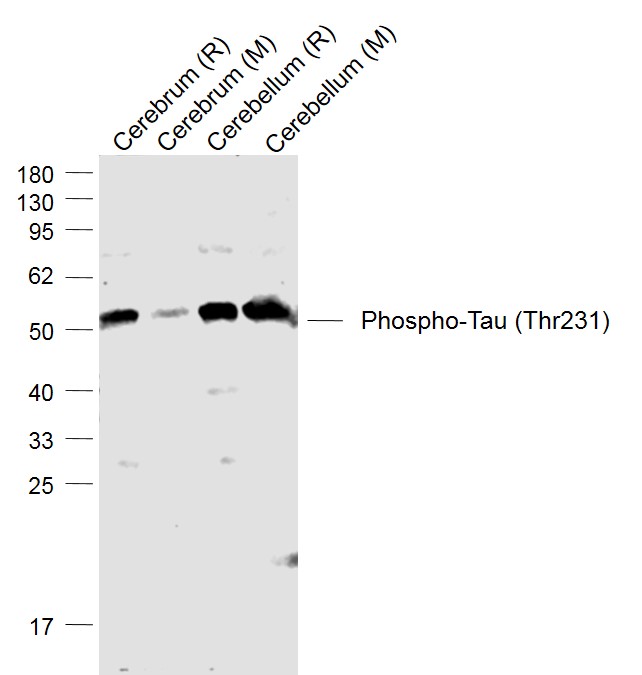 Tau (phospho Thr231)抗体 (GTX01563) | GeneTex中国官方网站