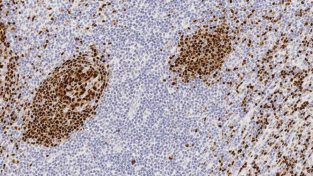 PAX5抗体 [1EW] (GTX01923) | GeneTex中国官方网站