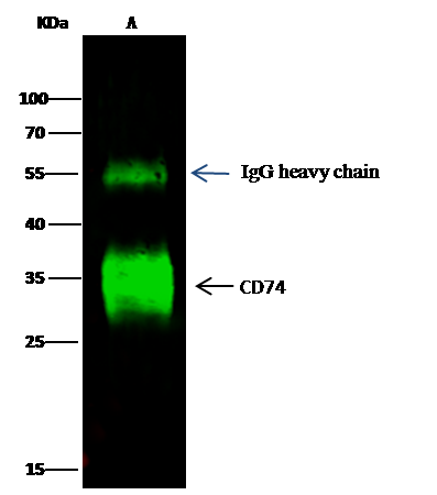 CD74抗体 (GTX02203) | GeneTex中国官方网站
