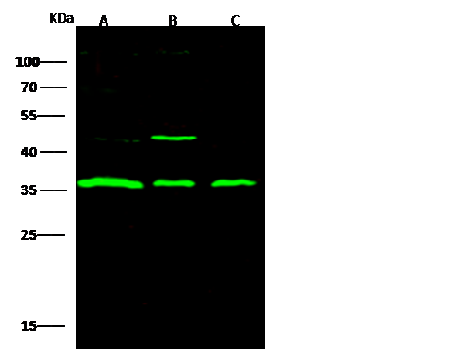 STUB1抗体 (GTX02364) | GeneTex中国官方网站