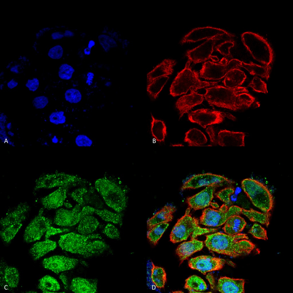 GLUT2抗体 (GTX02544) | GeneTex中国官方网站