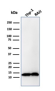 beta 2 Microglobulin antibody [B2M/1857R]价格,详情介绍-960化工网 – 960化工网