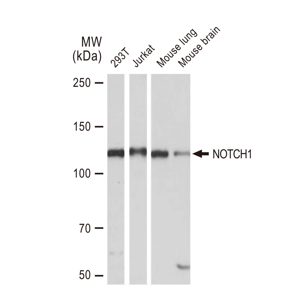 NOTCH1抗体 [GT1224] (GTX02821) | GeneTex中国官方网站