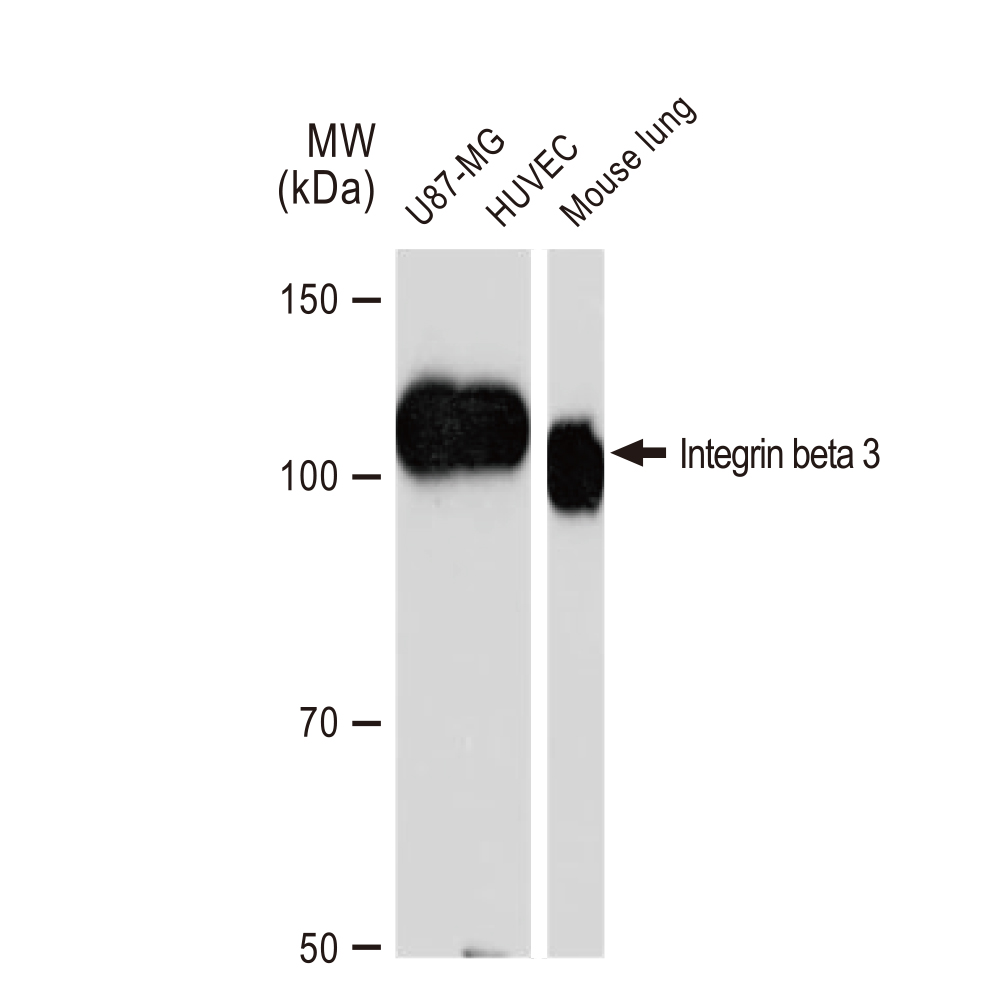 Integrin beta 3抗体 [GT1226] (GTX02823) | GeneTex中国官方网站