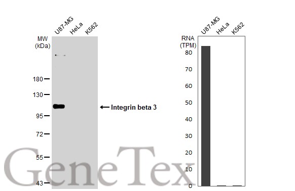 Integrin beta 3抗体 [GT1226] (GTX02823) | GeneTex中国官方网站