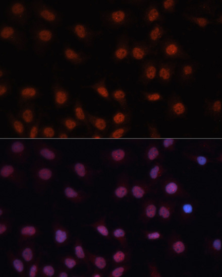 CDKN2A / p16INK4a抗体 (GTX03119) | GeneTex中国官方网站