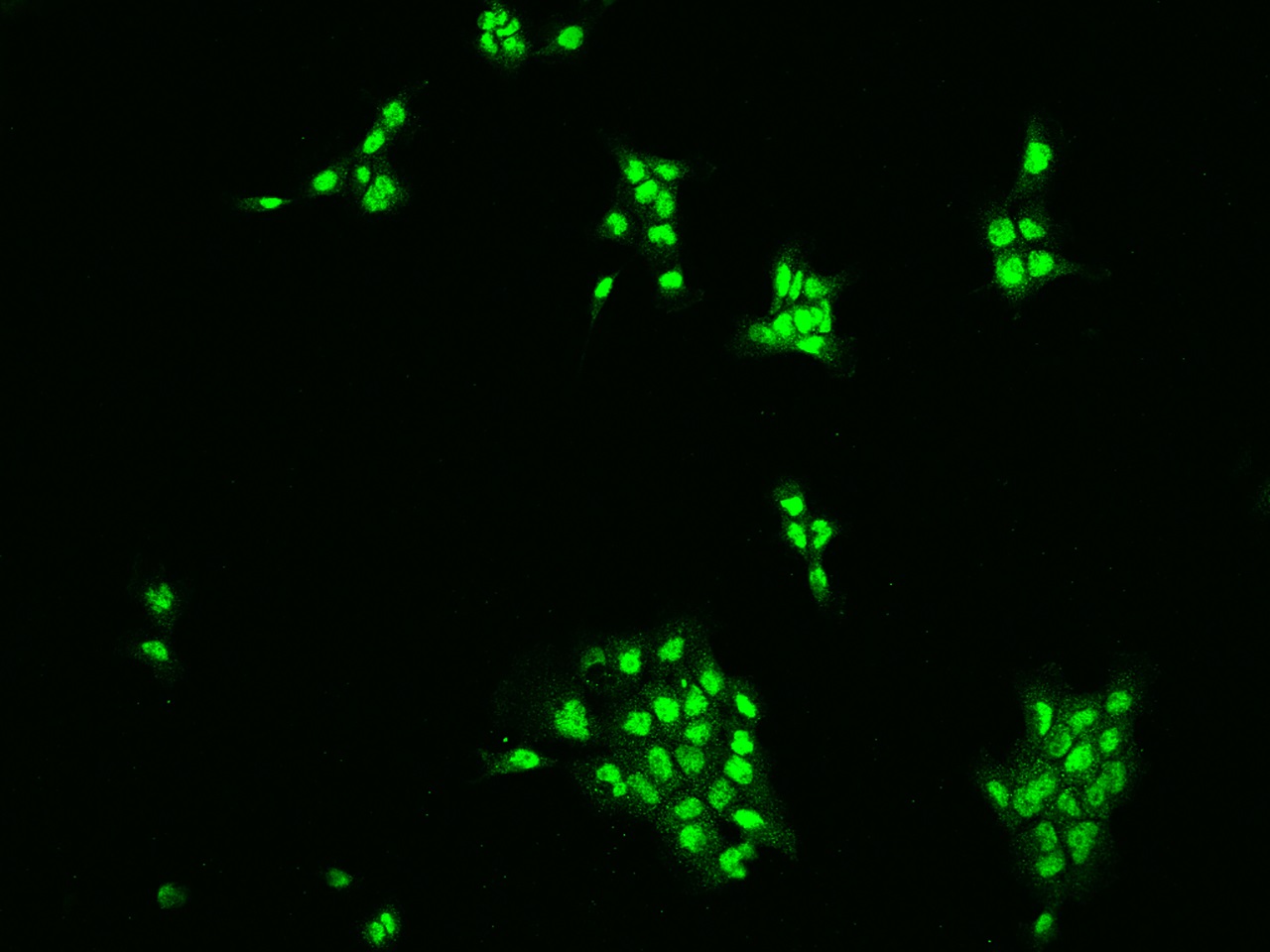 BBX抗体 (GTX03169) | GeneTex中国官方网站