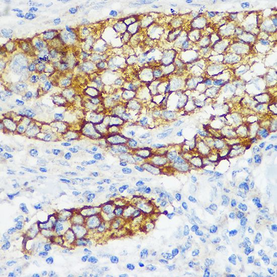 COL17A1抗体 [GT1273] (GTX03185) | GeneTex中国官方网站