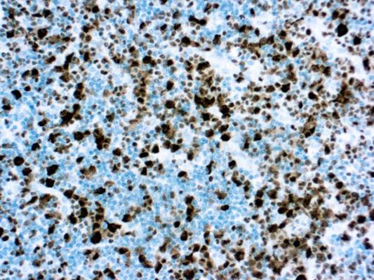 ALK antibody [4A4] (GTX03298) | GeneTex中国官方网站