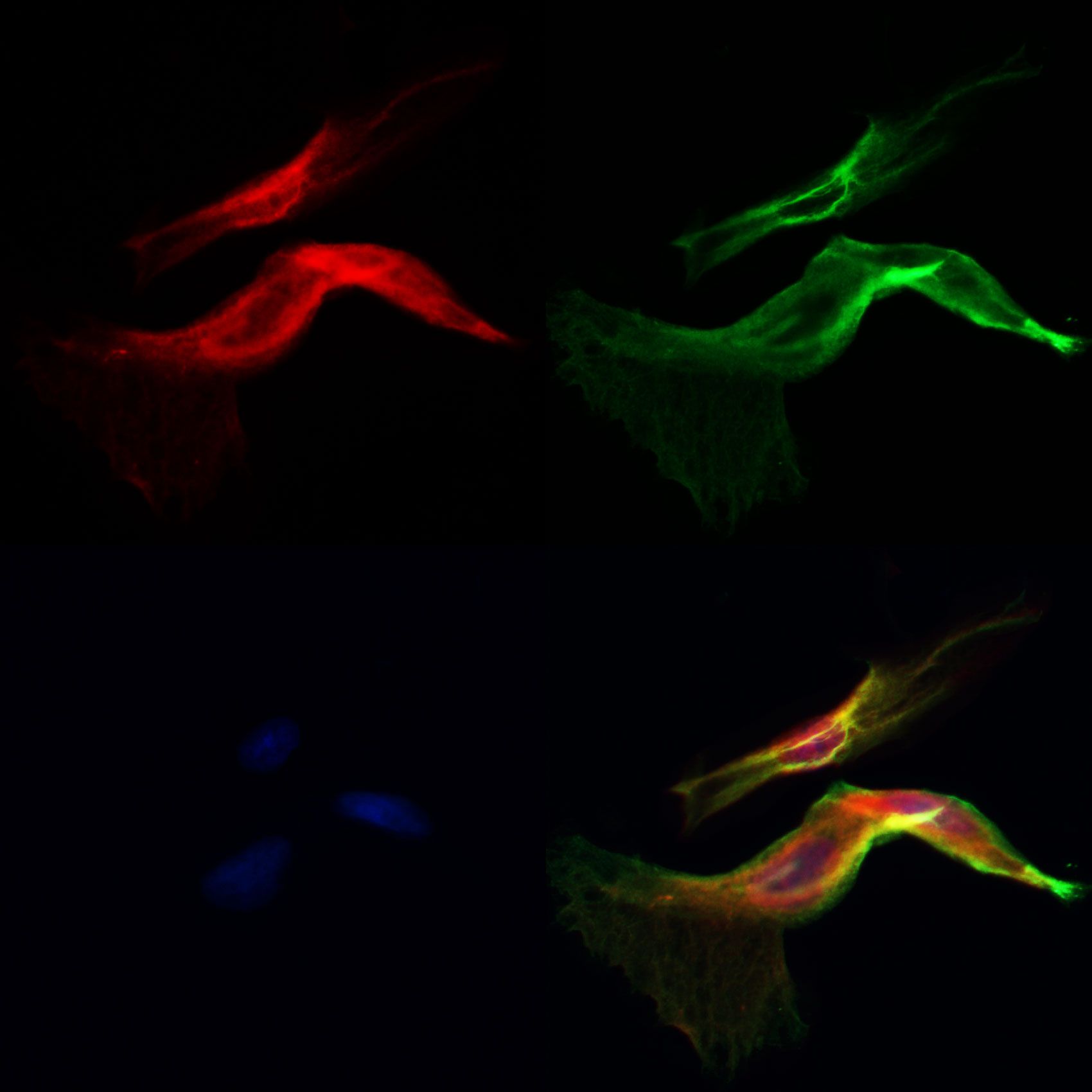 NG2抗体 (GTX03452) | GeneTex中国官方网站