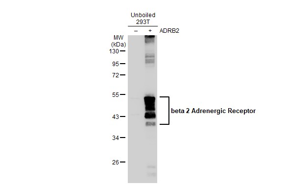 beta 2 Adrenergic Receptor抗体 [C2C3], C-term (GTX100040) | GeneTex中国官方网站