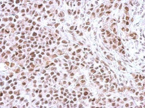 Chk1 (phospho Ser345)抗体 [C1C2], Internal (GTX100065) | GeneTex中国官方网站