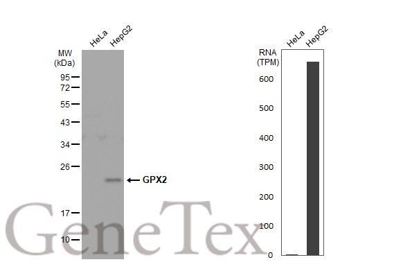 GPX2抗体 [C1C3] (GTX100292) | GeneTex中国官方网站