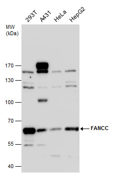 FANCC antibody [N1C1]价格,详情介绍-960化工网 – 960化工网