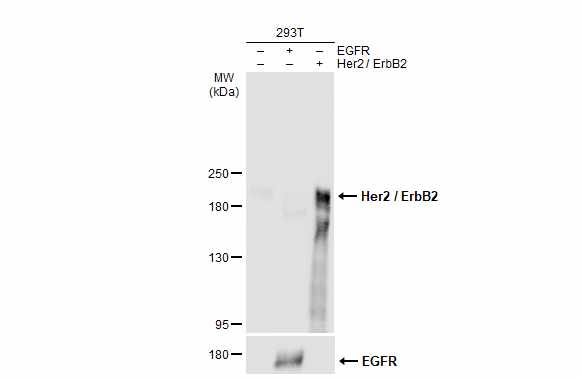 Her2 / ErbB2抗体 (GTX100509) | GeneTex中国官方网站