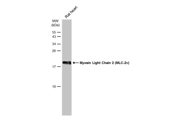 Myosin Light Chain 2 (MLC-2v)抗体 (GTX100714) | GeneTex中国官方网站
