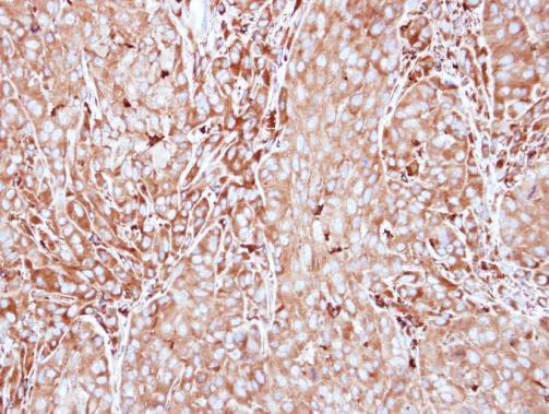 MMP3抗体 [N3C1], Internal (GTX100723) | GeneTex中国官方网站