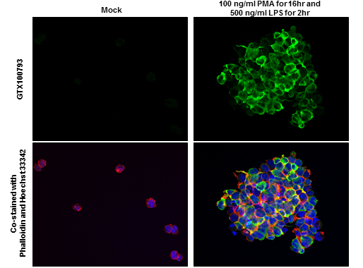 IL1 beta抗体 (GTX100793) | GeneTex中国官方网站