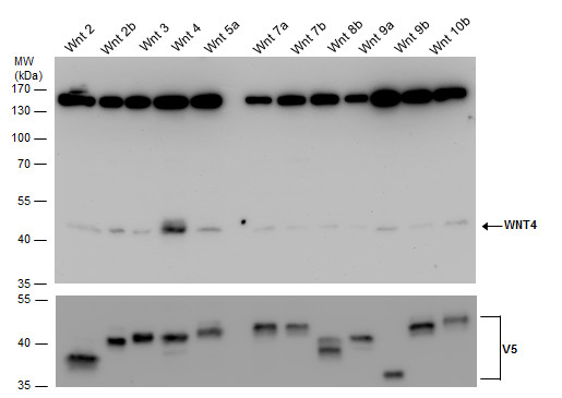 Wnt4抗体 (GTX101085) | GeneTex中国官方网站