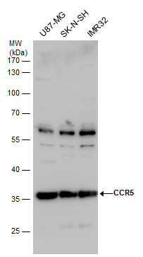 CCR5抗体 (GTX101330) | GeneTex中国官方网站