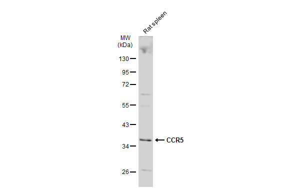 CCR5抗体 (GTX101330) | GeneTex中国官方网站