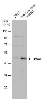 PAX8抗体 (GTX101583) | GeneTex中国官方网站