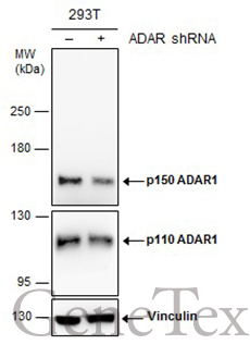 ADAR1抗体 [N3C1], Internal (GTX101602) | GeneTex中国官方网站