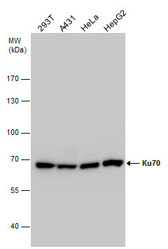 Ku70抗体 (GTX101820) | GeneTex中国官方网站