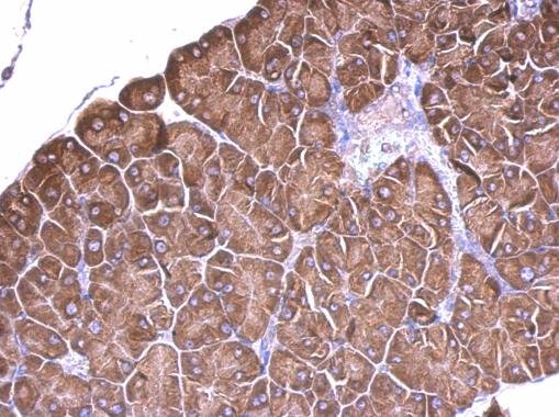 RPS15抗体 (GTX101839) | GeneTex中国官方网站