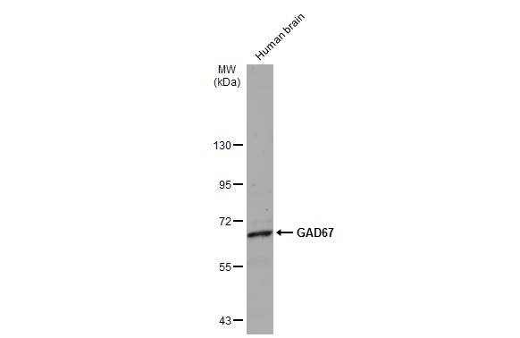 GAD67抗体 (GTX101881) | GeneTex中国官方网站