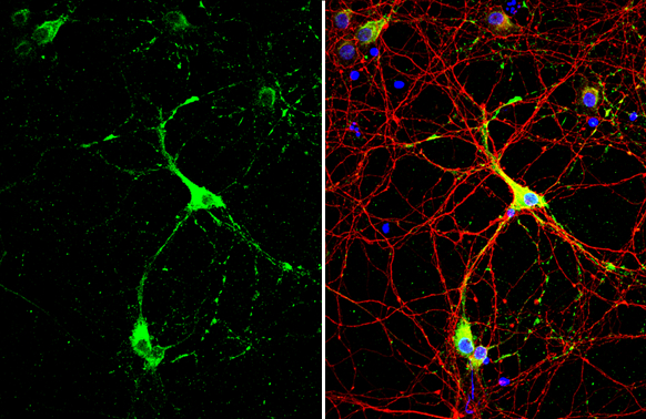 GAD67抗体 (GTX101881) | GeneTex中国官方网站