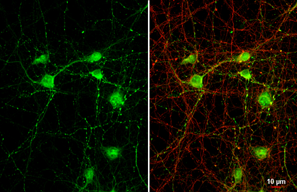 VGAT抗体 [N1N2], N-term (GTX101908) | GeneTex中国官方网站