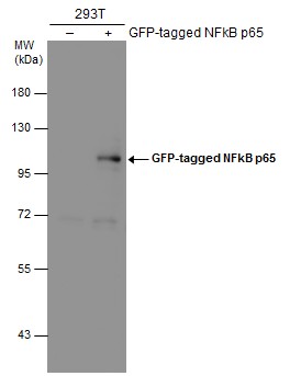 NFkB p65抗体 (GTX102090) | GeneTex中国官方网站