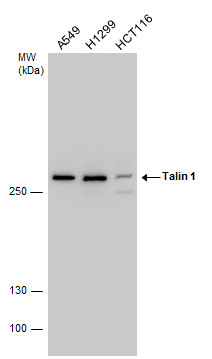 Talin-1抗体 [C3], C-term (GTX102215) | GeneTex中国官方网站