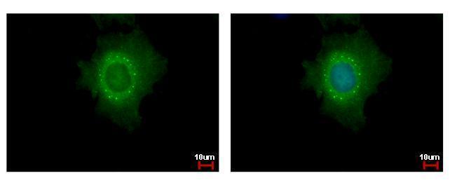 DDX6抗体 (GTX102795) | GeneTex中国官方网站