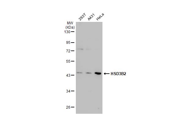 HSD3B2 antibody [N3C3]价格,详情介绍-960化工网 – 960化工网